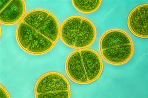 Chroococcus Turgidus Algae Light Micrograph Stock Image C057 7956 Science Photo Library