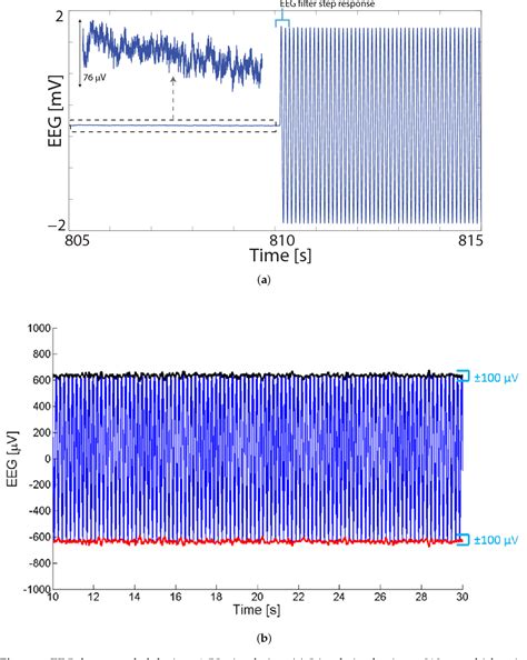 Figure 2 From Removal Of Gross Artifacts Of Transcranial Alternating