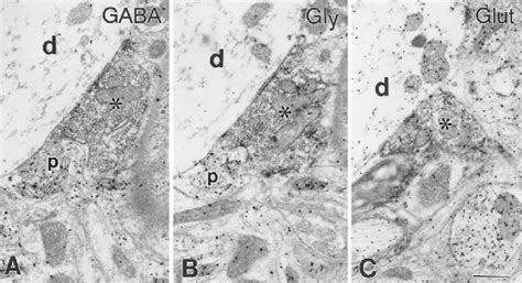 A C Electron Micrographs Showing Serial Ultrathin Sections Incubated