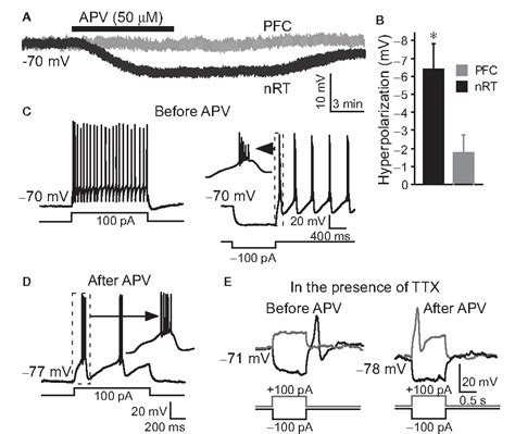 Figure 1 From Frontiers In Neural Circuits Neural Circuits Materials And Methods Brain Slices
