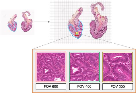 Comparative Analysis Of Diffusion Generative Models In Computational Pathology
