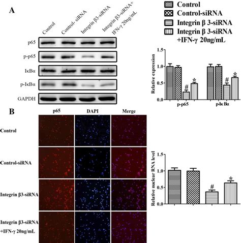 ifn γ induces gastric cancer cell proliferation and metastasis through