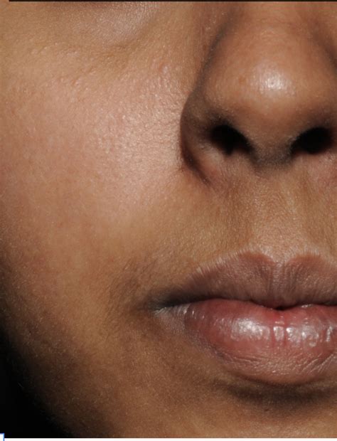 Dark Spot Correcting Serum Reduce Hyperpigmentation World Of Asaya