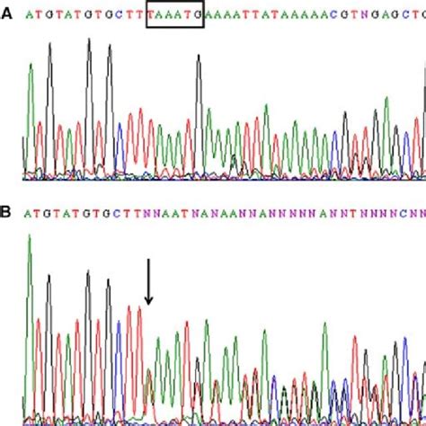 sequence electropherogram of a normal individual showing a wildtype