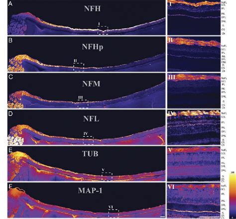 Figure 2 From Time Dependent Effects Of Focal Retinal Ischemia On Figure 2 From Time Dependent Effects Of Focal Retinal Ischemia On