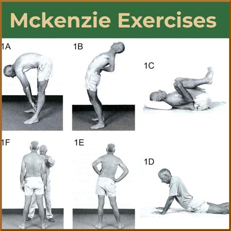Mckenzie Exercises Sports Medicine Review