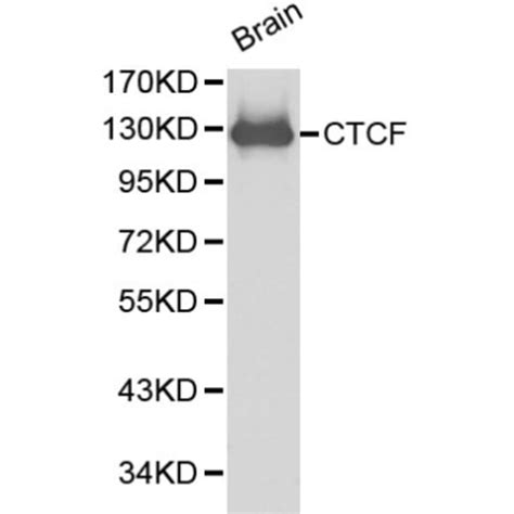 Anti Ctcf Antibody A29415