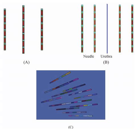 Schematic Diagram Of Seed Arrangement In The Prostate Of Patient 2 For