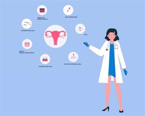 Polycystic Ovary Syndrome Pcos Symptoms Causes And Treatment