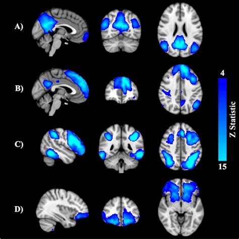 Resting State Networks Of Interest Posterior Default Mode Network