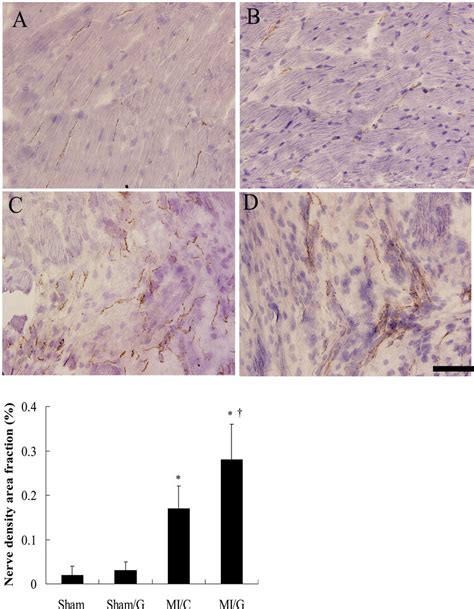 Immunohistochemical Staining For Tyrosine Hydroxylase Th In The