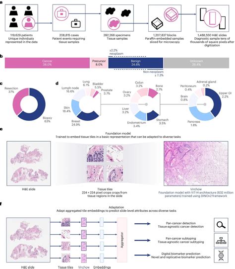 Ai Model Virchow Outperforms Clinical Methods In Cancer Detection