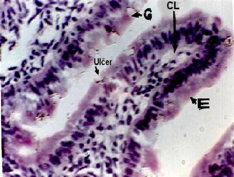 Micrograph Of Duodenum Of Download Scientific Diagram