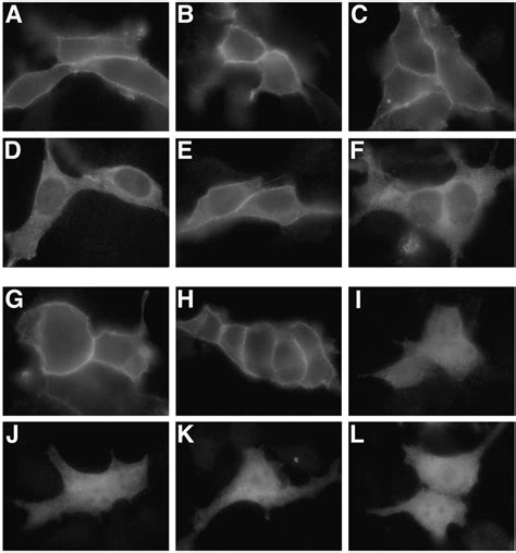 Subcellular Localization Of Binding Region Mutants Of S And Q By Download Scientific Diagram