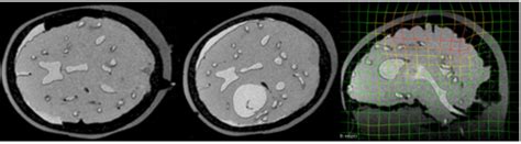 9 Examples Of Mri Phantom Acquisitions Left Image Show The