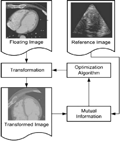 Mutual Information Based Image Registration Download Scientific Diagram