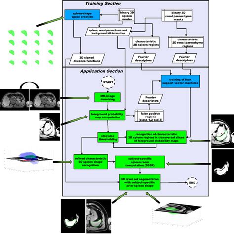Overview Of Spleen Segmentation Framework Which Is Divided Into The