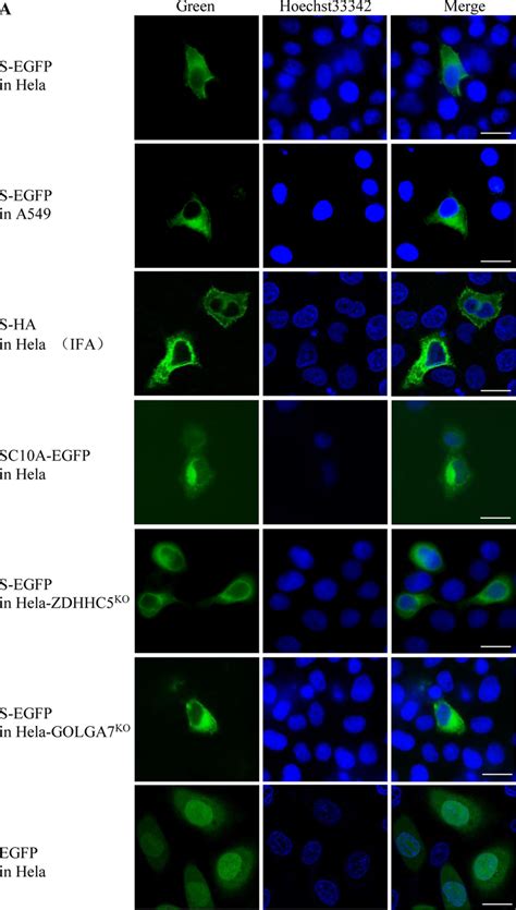 Fluorescence Micrographs Of Cells Expressing A Single Protein Or