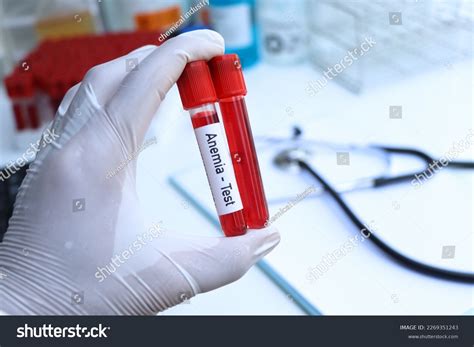Anemia Testing Images Stock Photos D Objects Vectors Shutterstock