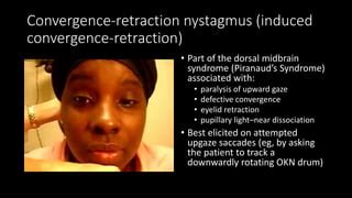 Central Vertigo And Nystagmus Pptx