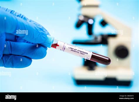 Long Qt Syndrome Genetic Test Identifies Mutations In Genes Like Kcnq1 Causing Long Qt