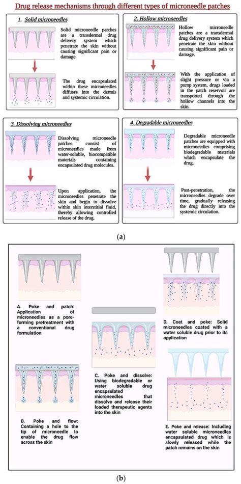 Pharmaceutics Special Issue Microarray Patches For Transdermal Drug