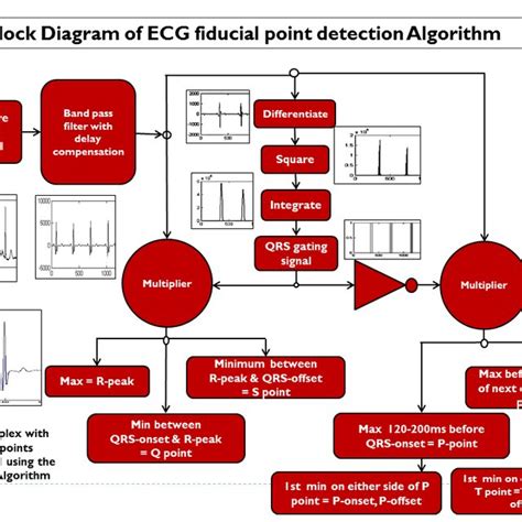 ecg fiducial points detection system download scientific diagram