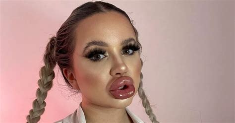 Barbie Bimbo Abandoned By Family Over Plastic Transformation Daily Star