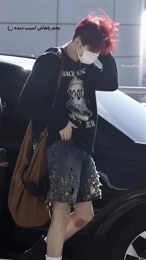 پای یونجون آسیب دیده و موهاش رو هم قرمز کرده، بله یه سری لینک عکس