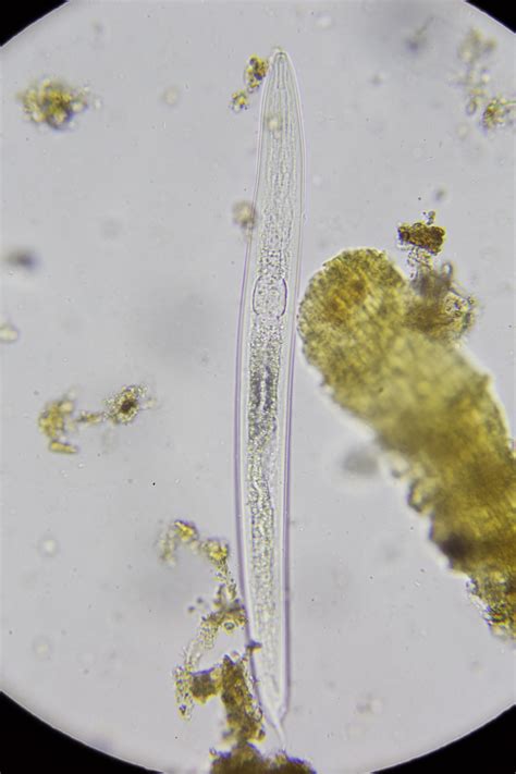 Bacterial Feeding Nematode Under The Microscope Rnotillgrowery