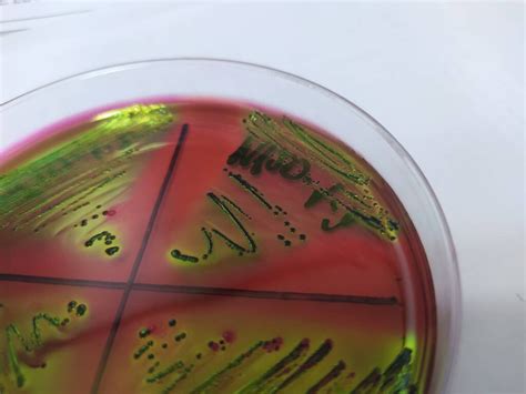 Imágenes De Escherichia Coli Bacteria Fotos E Imágenes De Stock De Escherichia Coli Bacteria