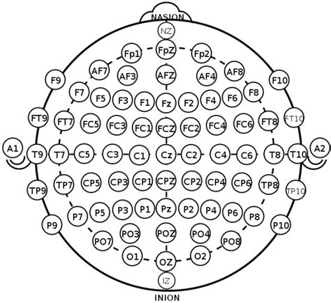 Electroencephalography Source Localization Pmc