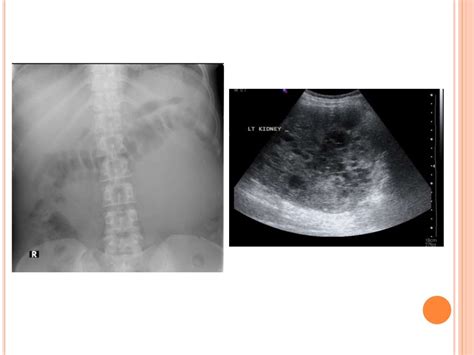 Conventional Nephroradiology