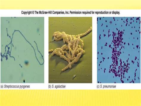 Streptococcus Pptx Ear Nose And Throat Conditions Diseases And Conditions Streptococcus Pptx Ear Nose And Throat Conditions Diseases And Conditions