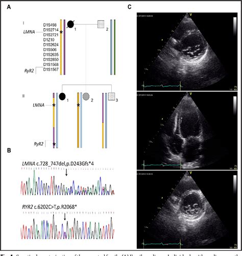 Figure 1 From Functional Characterization Of A Novel Truncating Mutation In Lamin A C Gene In A