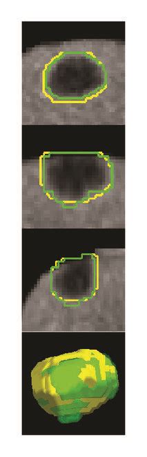 Segmentation Results Obtained By The Proposed Method Compared To Ground