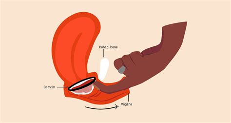How To Remove Flex Disc Like A Pro The Fornix Flex