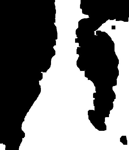 Python How To Detect Text On An X Ray Image With Opencv Stack Overflow