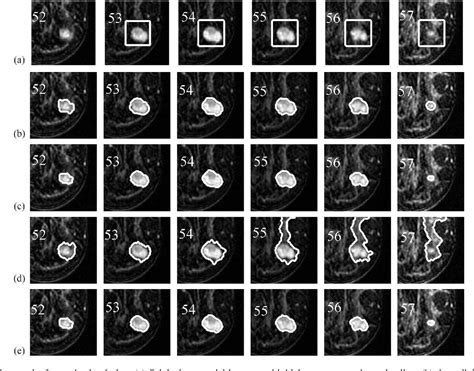 Figure 3 From A New Background Distribution Based Active Contour Model