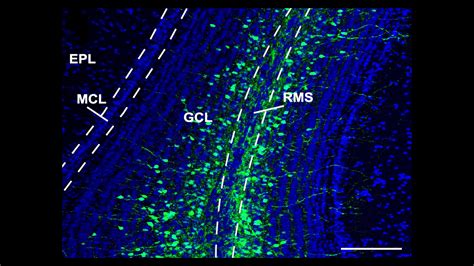 Oxytocin Drives Development Of Neural Connections In Adult Born Neurons