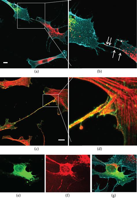 Cellular Protrusions Formed By Ocular Trabecular Meshwork Tm Cells Download Scientific