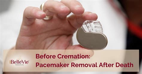 Before Cremation Pacemaker Removal After Death Cremation Blog
