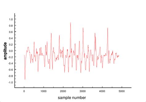 The Normalized Time Series Obtained From The Recording Download Scientific Diagram