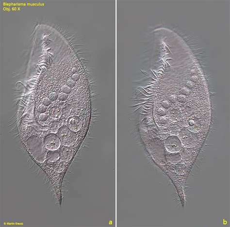 Blepharisma Musculus Real Micro Life