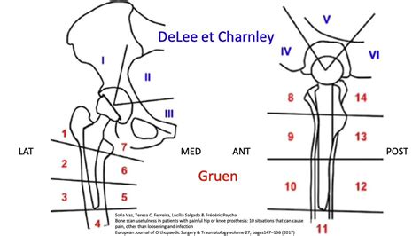 Philippe Meyer On Linkedin Classifications Utiles Usefull