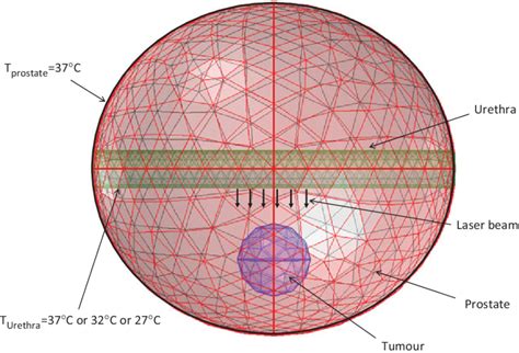 Meshed Finite Element Prostate Model With Corresponding Boundary Download Scientific Diagram