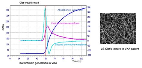 Examples Of Cwa And Clots Texture Image Of Patients With Treatment With Download Scientific