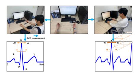 Bio Metric Authentication With Electrocardiogram Ecg By Considering Variable Signals