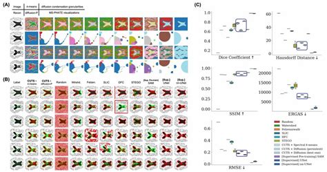 Segmenting Ventricles In Brain Mri Images A Multigranular