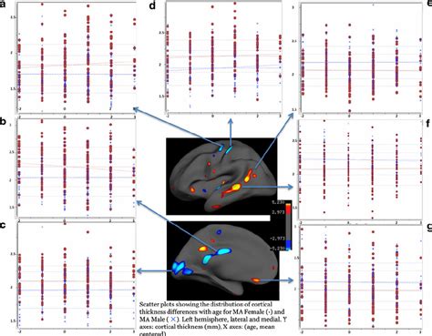 Sex Based Difference In Cortical Thickness Y Axis With Age X Download Scientific Diagram
